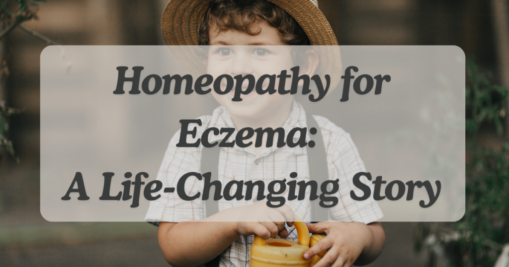 Homeopathy for Eczema: A Life-Changing Story - Emily Frye Homeopathy